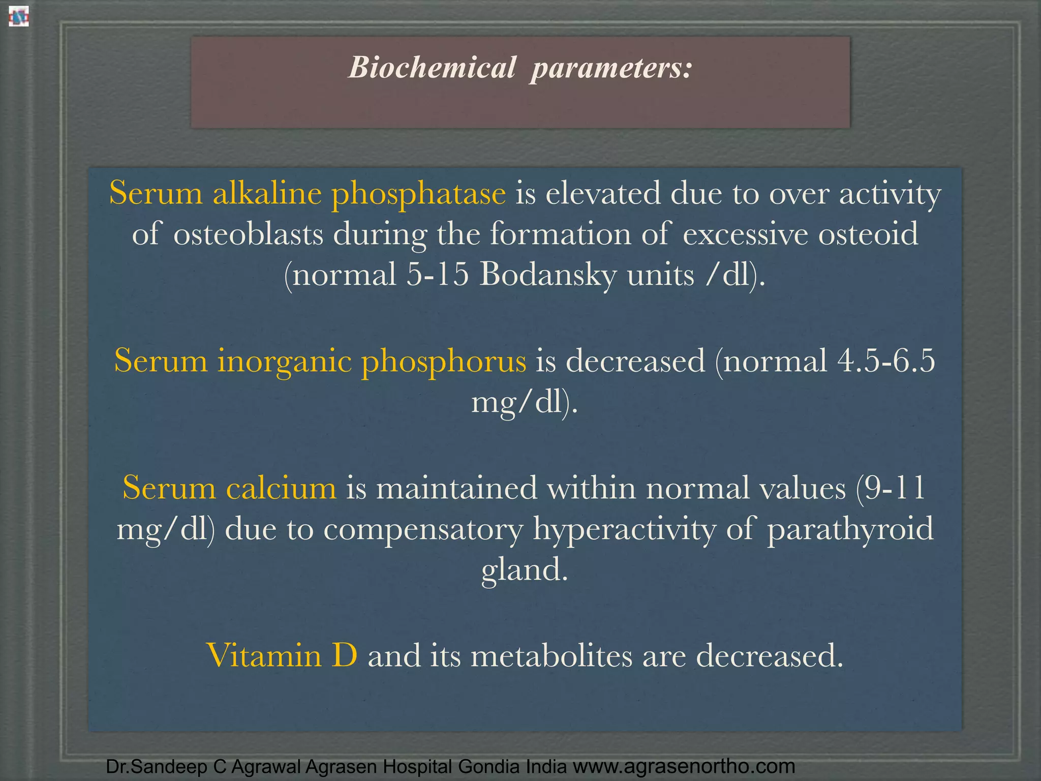 Understanding rickets types,diagnosis,prevention & treatment dr.sandeep ...