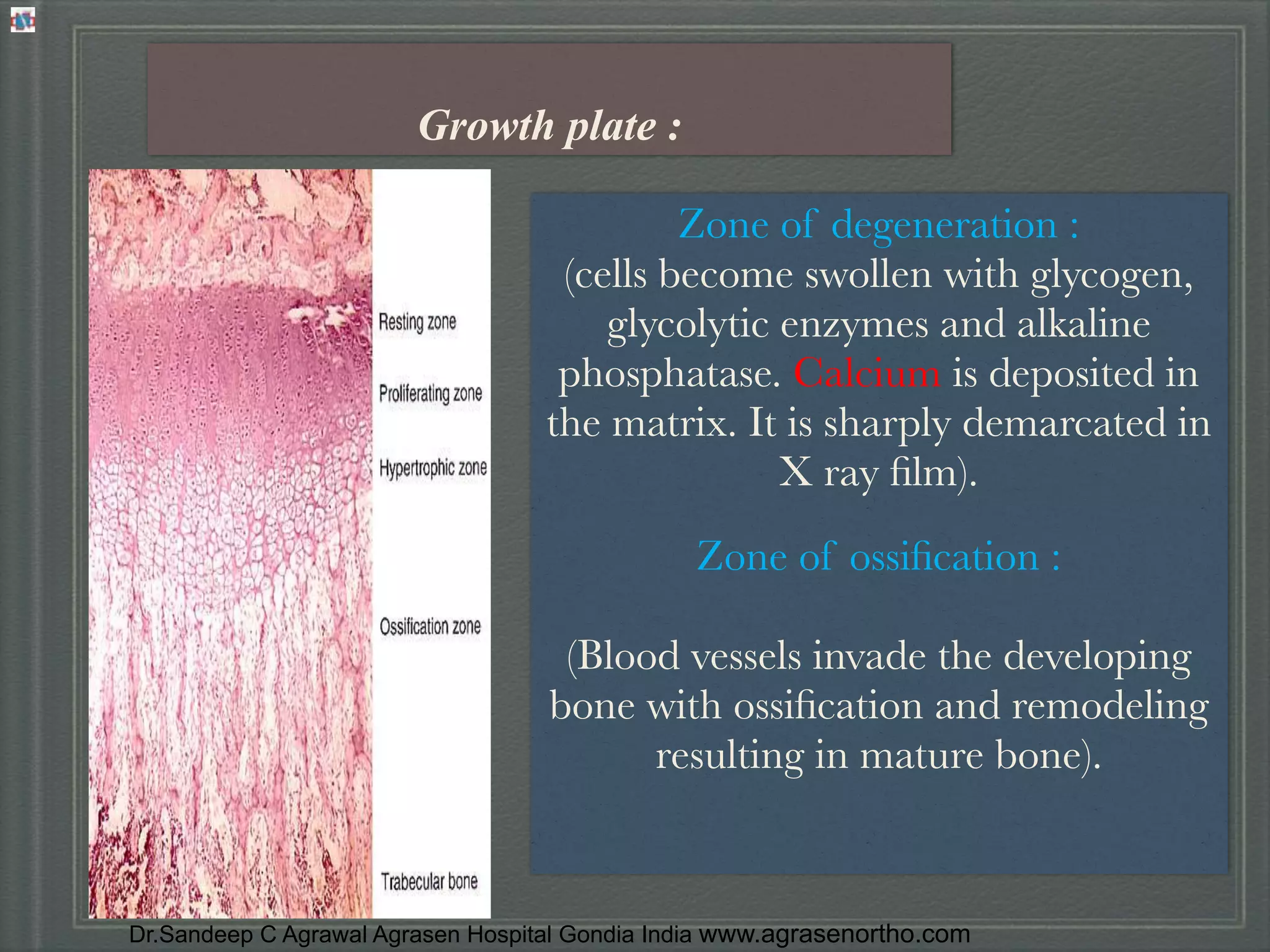 Understanding rickets types,diagnosis,prevention & treatment dr.sandeep ...