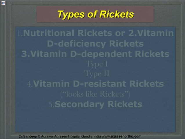 Understanding rickets types,diagnosis,prevention & treatment dr.sandeep ...