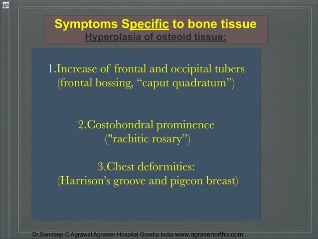 Understanding rickets types,diagnosis,prevention & treatment dr.sandeep ...