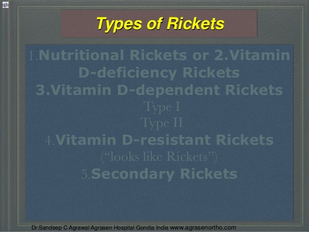 Understanding rickets types,diagnosis,prevention & treatment dr.sande…