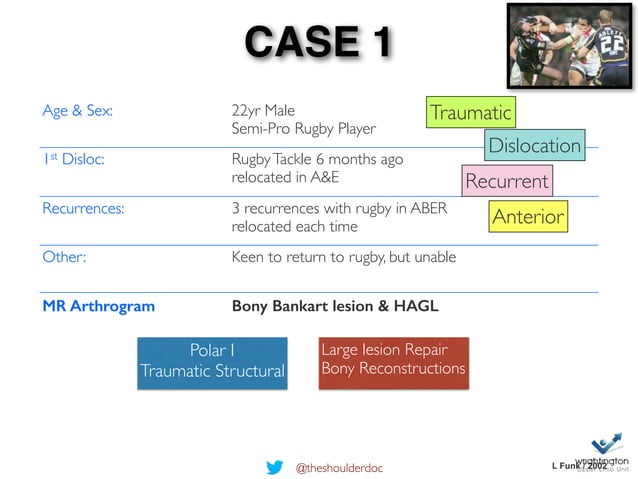 Understanding shoulder instability | PDF