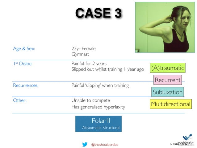 Understanding shoulder instability | PDF