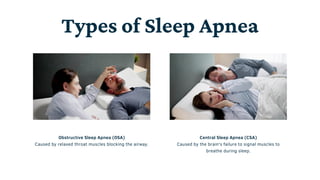Understanding Sleep Apnea - Shawn Younessi | PPT