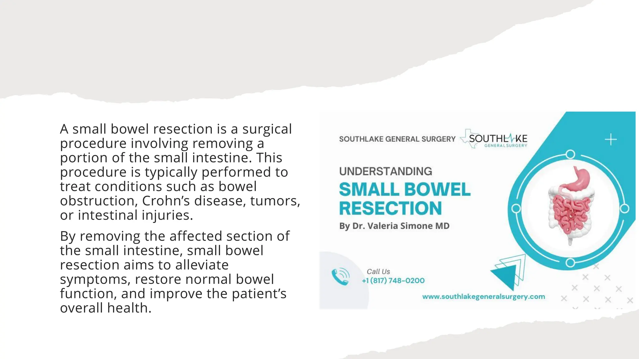 Understanding Small Bowel Resection.pdf