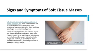 Understanding Soft Tissue Masses - Diagnosis and Care.pdf