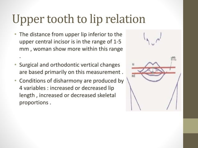 Understanding soft tissues | PPTX | Dental Health | Diseases and Conditions