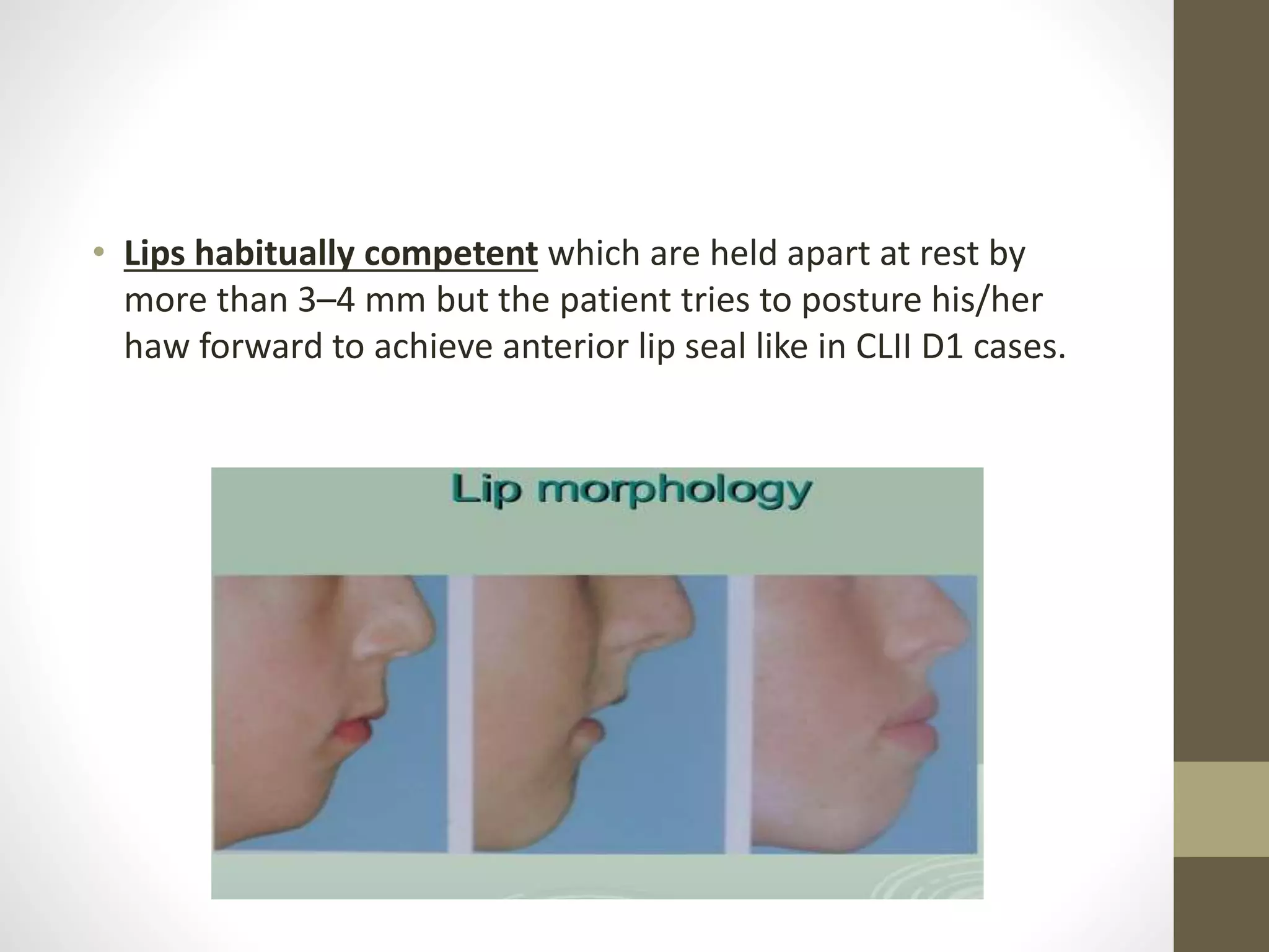 Understanding soft tissues | PPTX