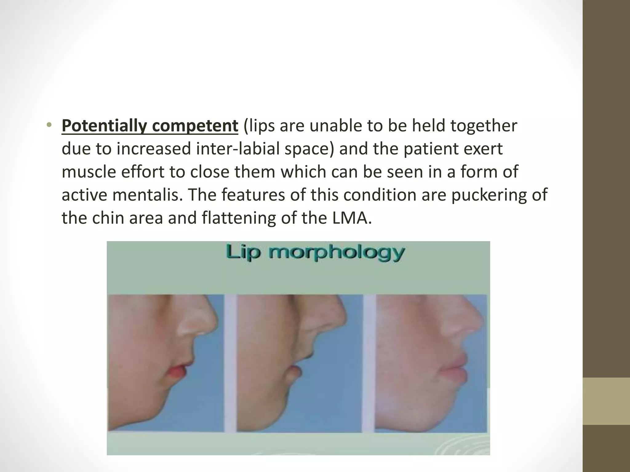 Understanding soft tissues | PPTX