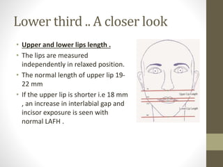 Understanding soft tissues | PPTX