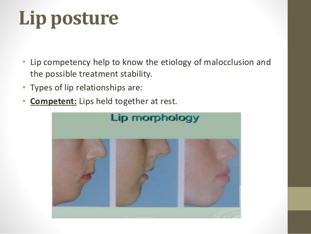 Understanding soft tissues