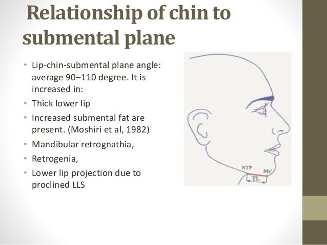 Understanding soft tissues