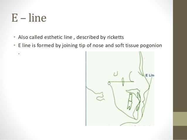 Understanding soft tissues