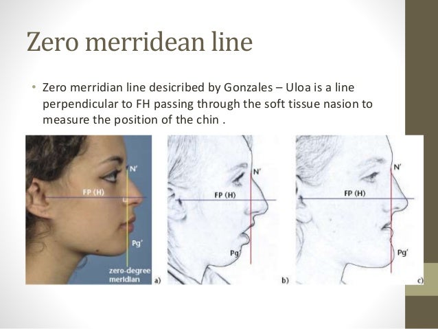 Understanding soft tissues