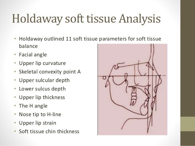 Understanding soft tissues