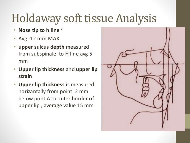 Understanding soft tissues
