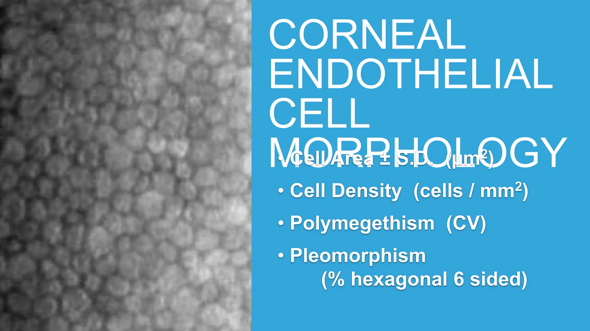 Understanding Specular Microscopy.ppt