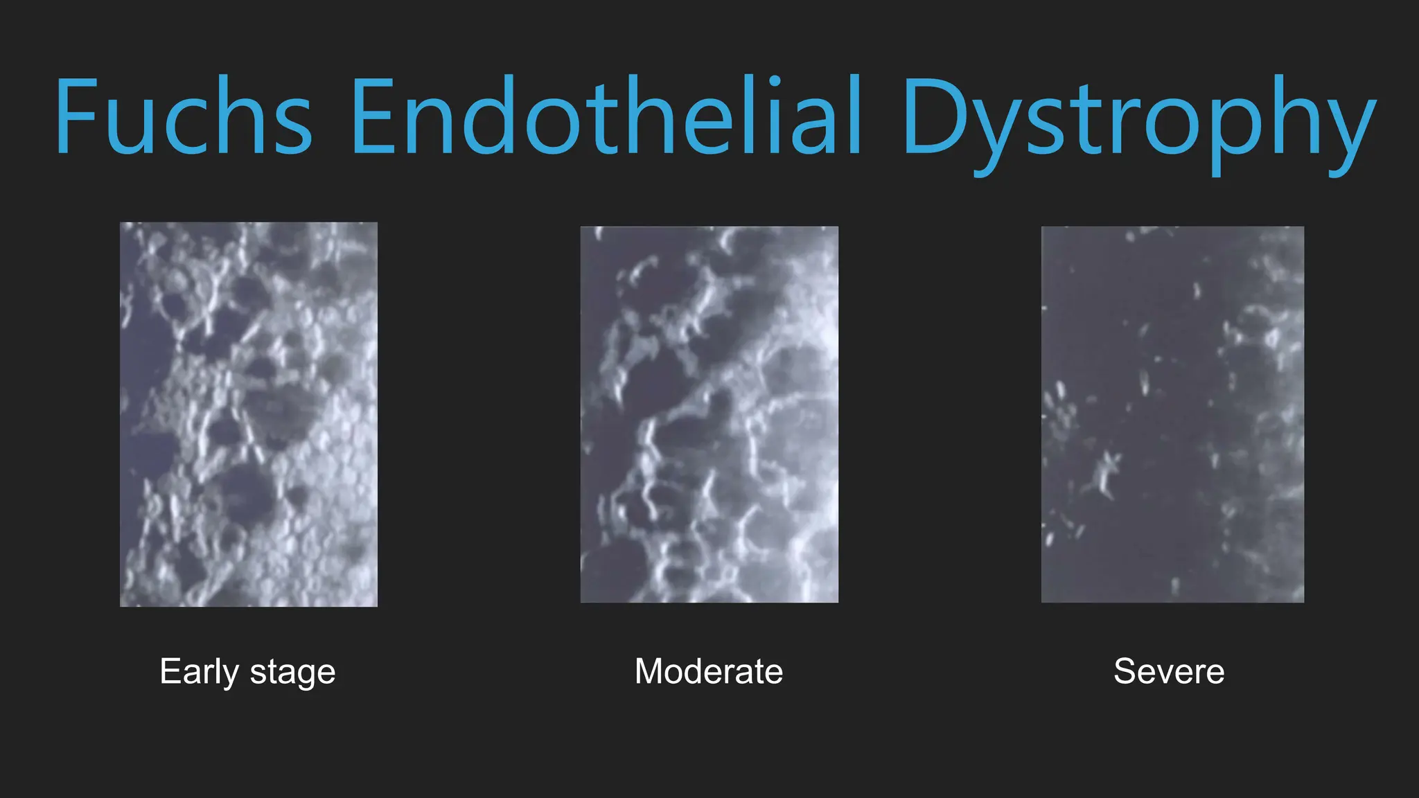 Understanding Specular Microscopy.ppt