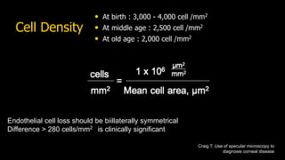 Understanding Specular Microscopy.ppt | Eye and Vision Conditions ...