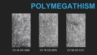 Understanding Specular Microscopy.ppt | Eye and Vision Conditions ...