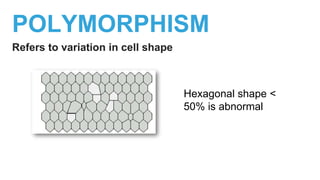 Understanding Specular Microscopy.ppt | Eye and Vision Conditions ...