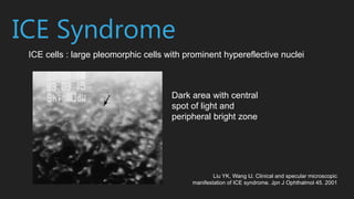 Understanding Specular Microscopy.ppt