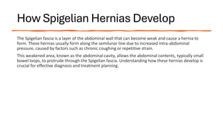 Understanding Spigelian Hernia - Causes & Treatments.pdf