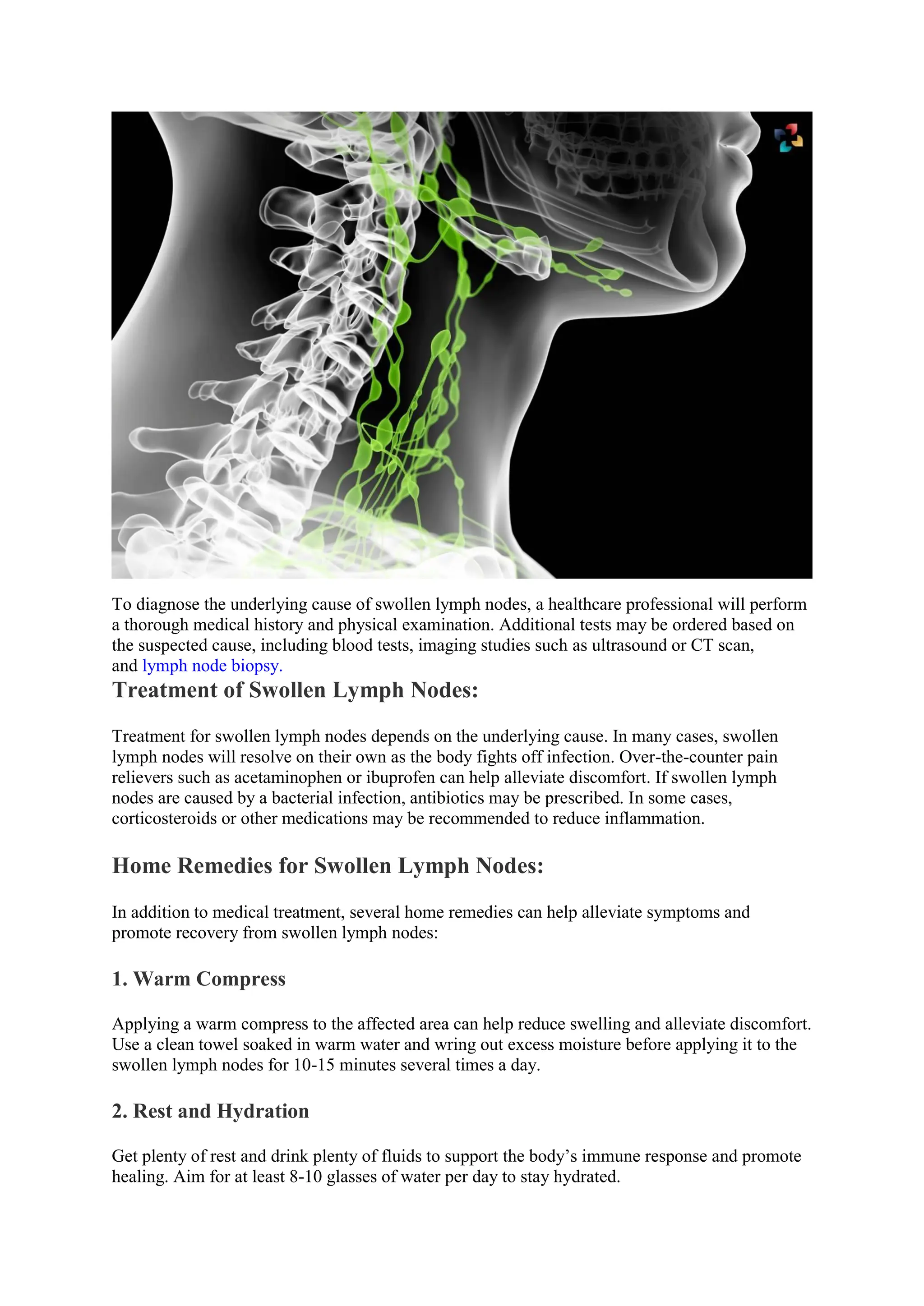 Swollen Lymph Nodes: Home Remedies, Causes, Symptoms, and Treatment ...
