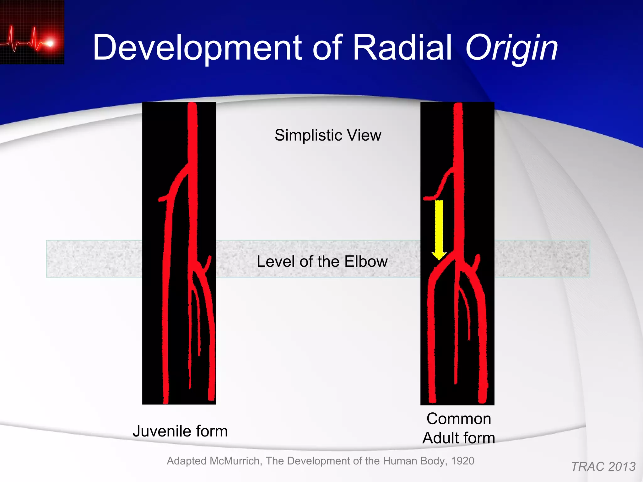 Gilchrist IC - Anatomy of radial and brachial arteries | PDF