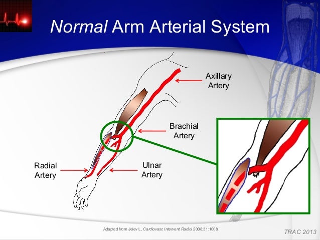 Gilchrist IC - Anatomy of radial and brachial arteries