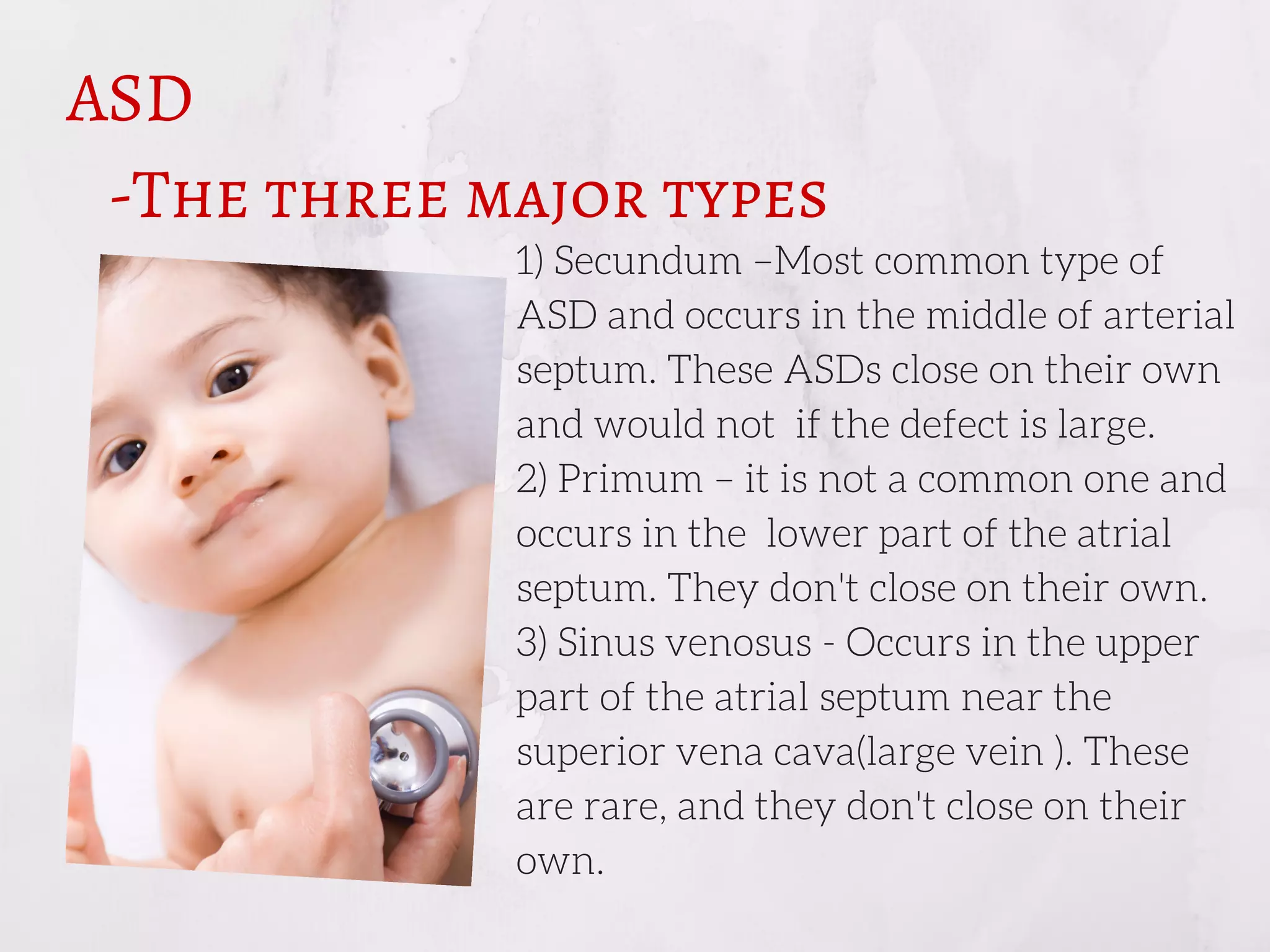 Atrial Septal Defect | PDF