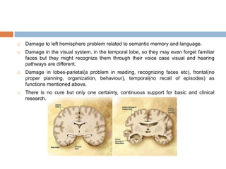 Understanding the Brain : The Neurobiology of Everyday Life Final ...