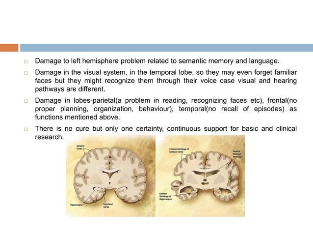 Understanding the Brain : The Neurobiology of Everyday Life Final ...