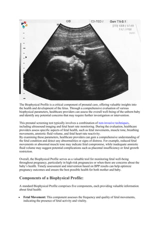 Biophysical Profile (BPP): Components, Significance, Interpretation ...