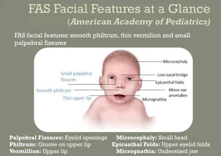 Understanding the brain final project - fas | PDF | Pregnancy ...