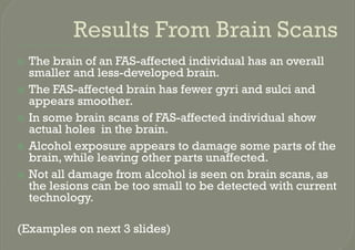 Understanding the brain final project - fas | PDF | Pregnancy ...