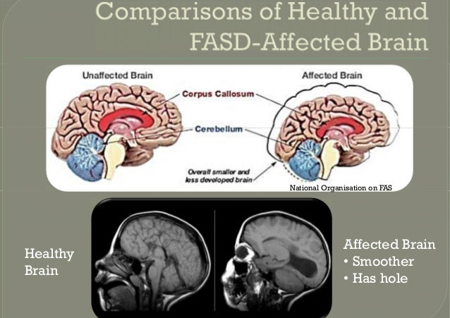 Understanding the brain final project - fas