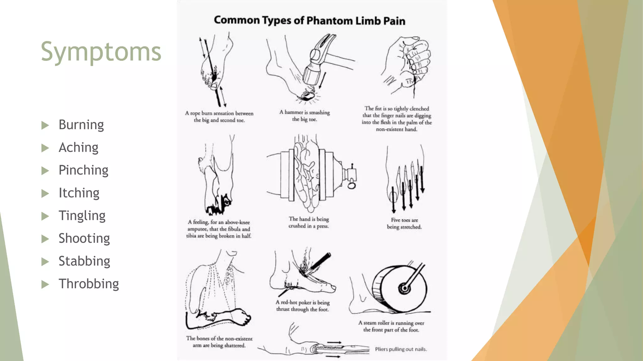 Understanding the Brain - Phantom Limb Syndrome.pptx