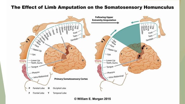 Understanding the Brain - Phantom Limb Syndrome.pptx