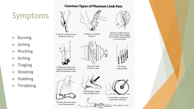 Understanding the Brain - Phantom Limb Syndrome.pptx