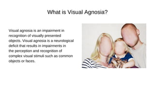 Understanding the Brain: Final Project - Visual Agnosia | PDF