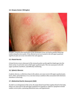 Cause of Left Upper Quadrant Pain: 20 Potential Reasons | The ...