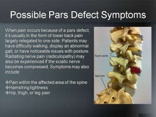 Understanding the Causes of Pars Defects