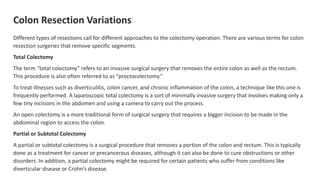 Understanding the Colectomy Procedure.pdf