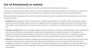 Understanding the Colectomy Procedure.pdf