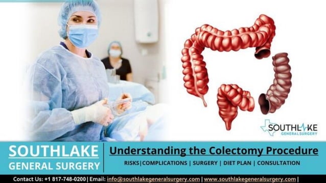 Understanding the Colectomy Procedure.pdf