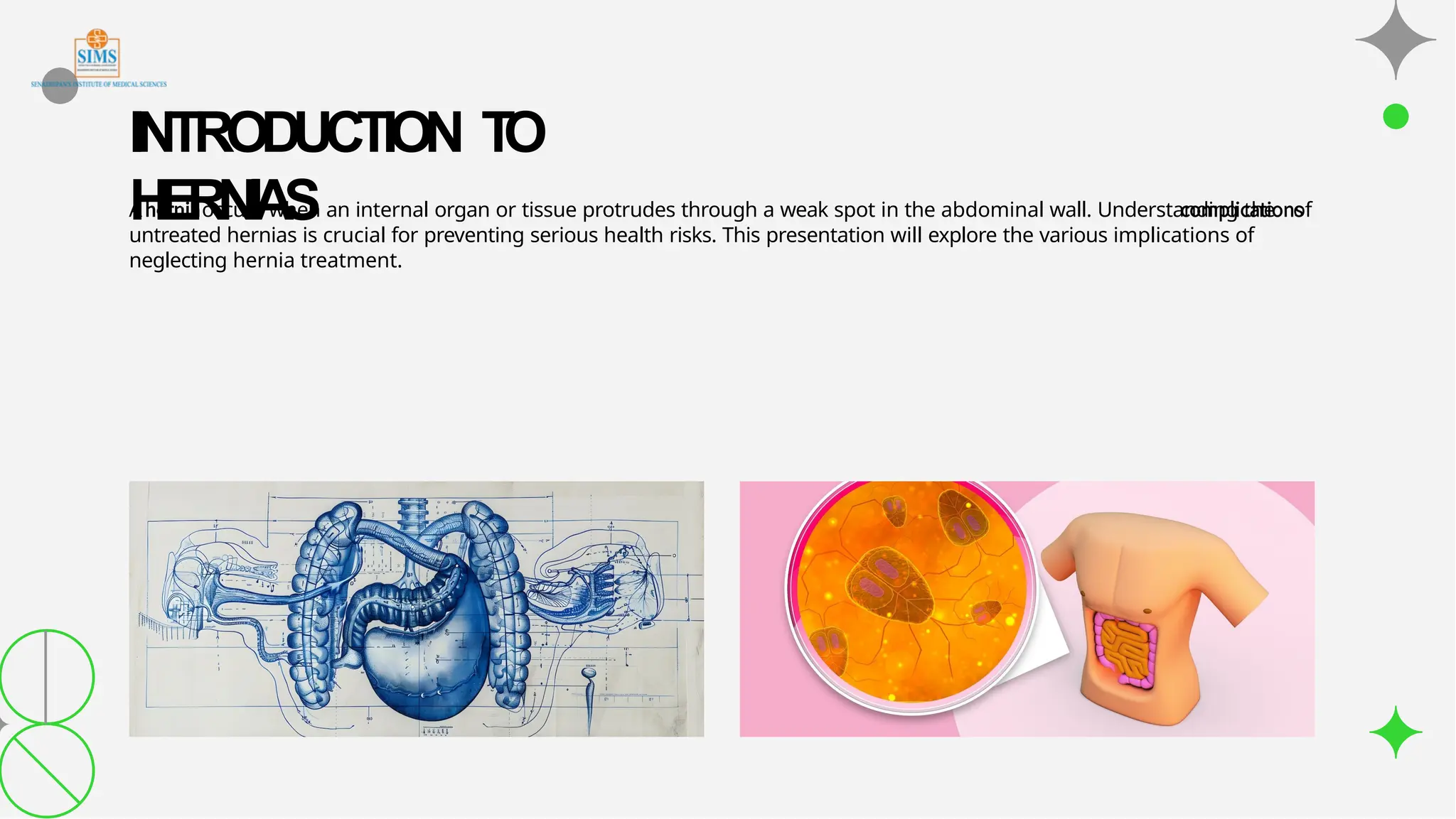 Understanding the Complications of Untreated Hernias.pptx