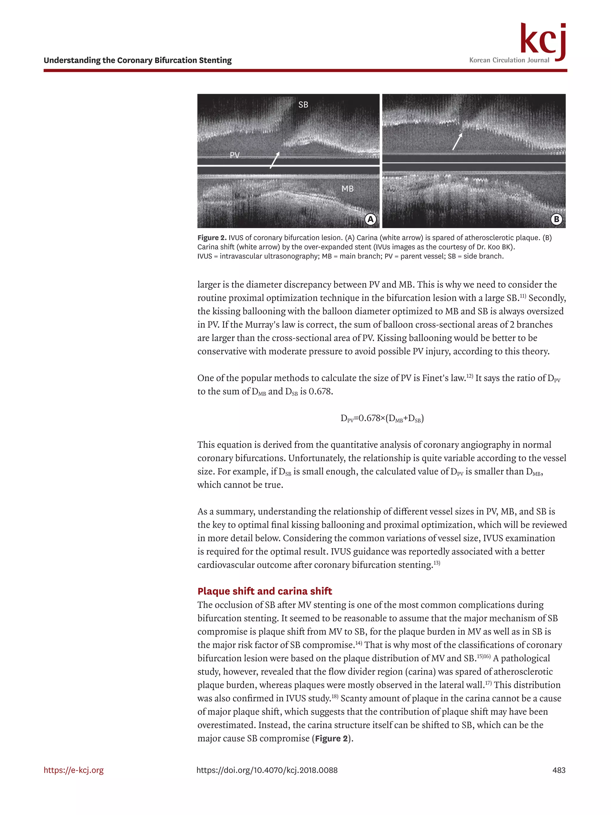 Understanding the coronary bifurcation stenting | PDF