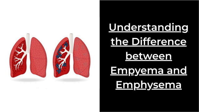 Understanding the Difference between Empyema and Emphysema.pdf
