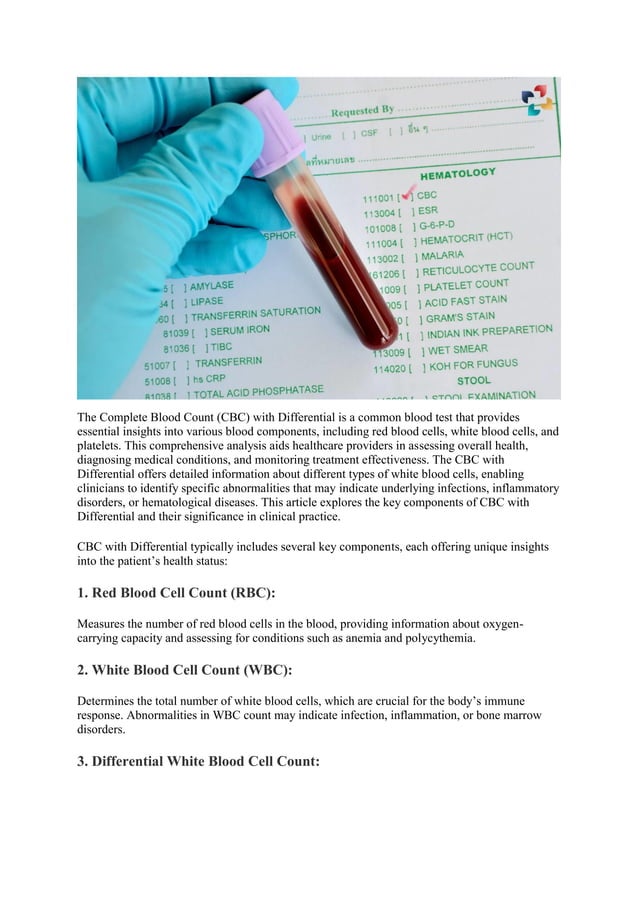 Importance of CBC with Differential in Healthcare | The Lifesciences ...